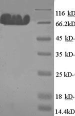 Recombinant Rat MAPT / Tau Protein – enQuire BioReagents