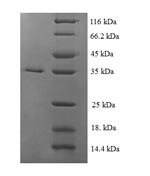 Recombinant E. coli ssbF Protein – enQuire BioReagents