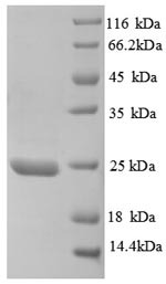 Recombinant Human TIMP-3 Protein – enQuire BioReagents