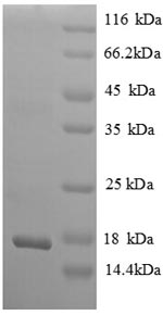 Recombinant Rat beta-NGF / Beta-NGF Protein – enQuire BioReagents
